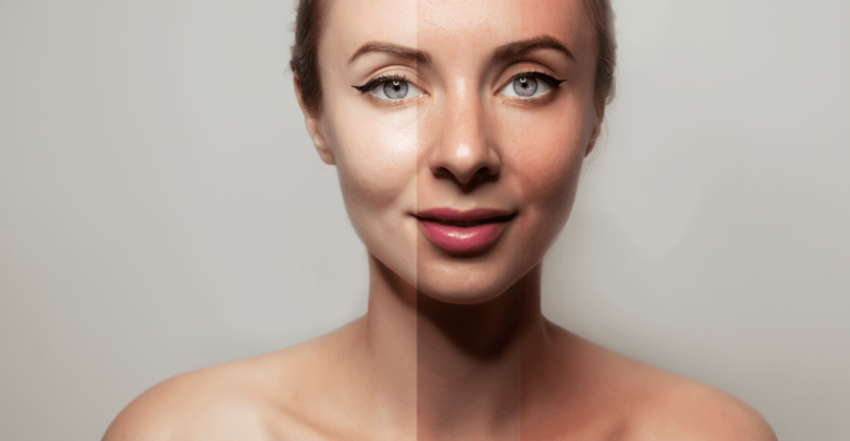 4 Steps Skin Care Regime for Pigmentation - Dermatocare