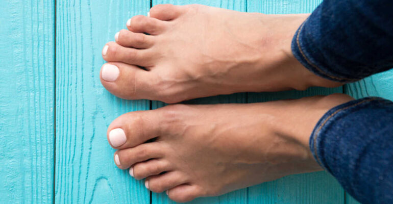 Get rid of toe/knee callus in 6 steps I Dermatologist Guide | Dermatocare