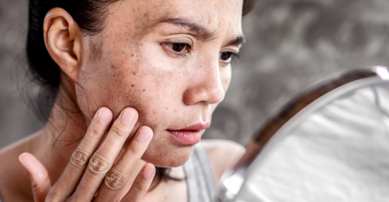 37 Scientifically proven Skin-lightening Ingredients | Dermatocare